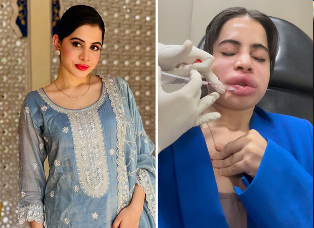 Uorfi Javed gets lip fillers dissolved on camera; reveals painful ...